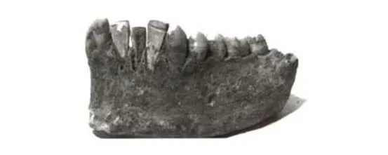 Los implantes dentales desde sus incios - Dentisalut