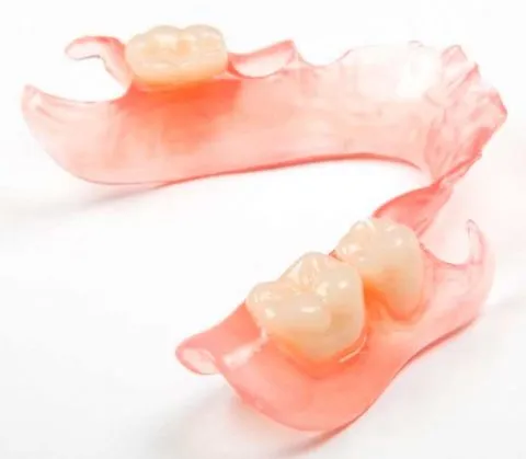 Todo sobre las prótesis parciales removibles - Dentisalut